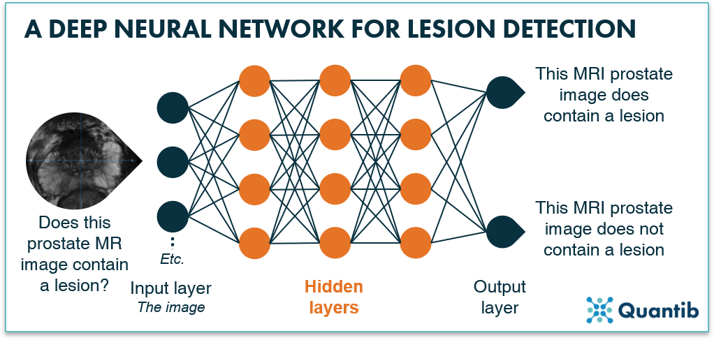 Deep Learning Radiology The Secret Of Convolutional Neural Networks